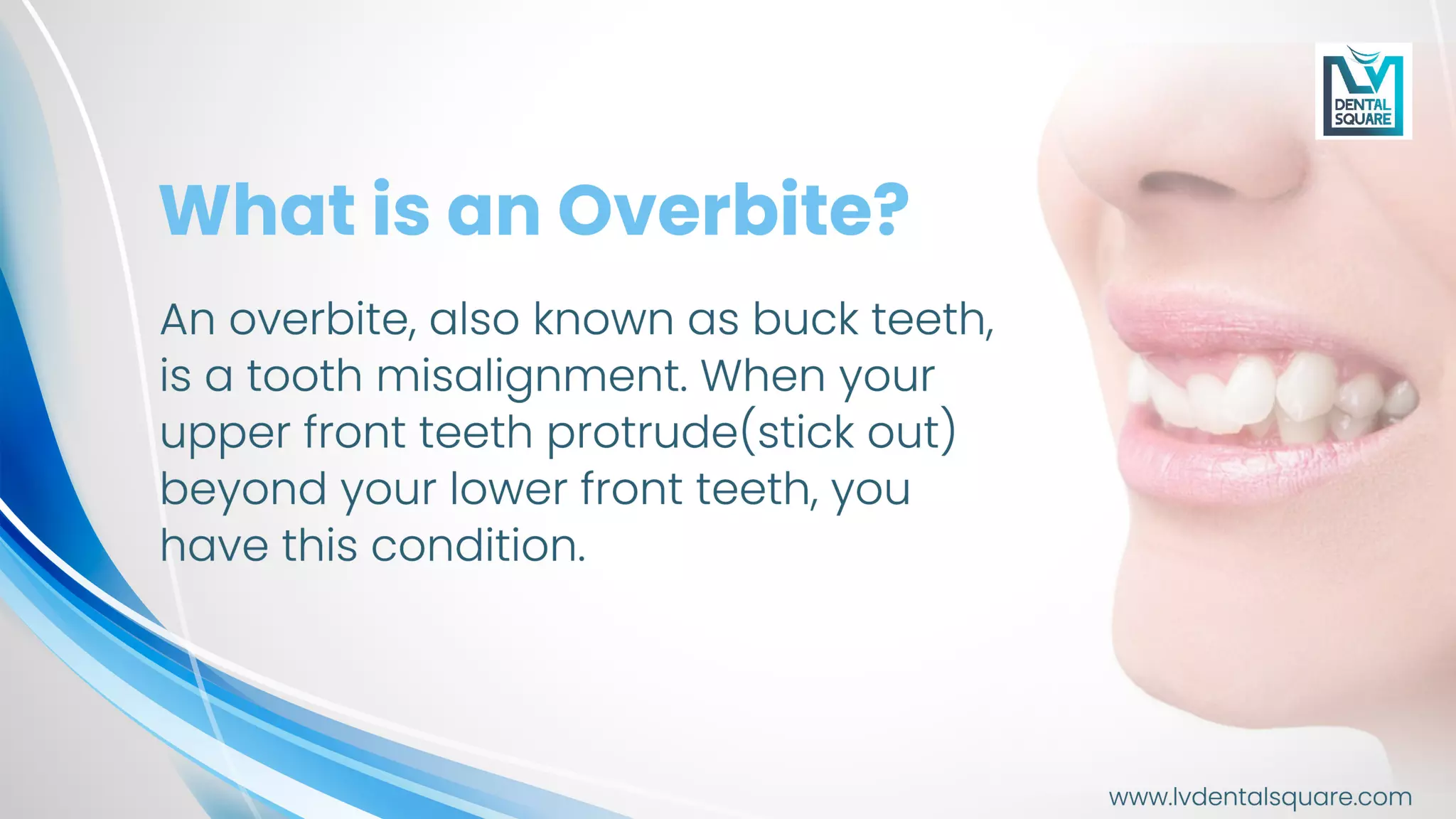 how Invisalign can fix an overbite | PDF