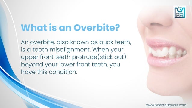 how Invisalign can fix an overbite | PDF