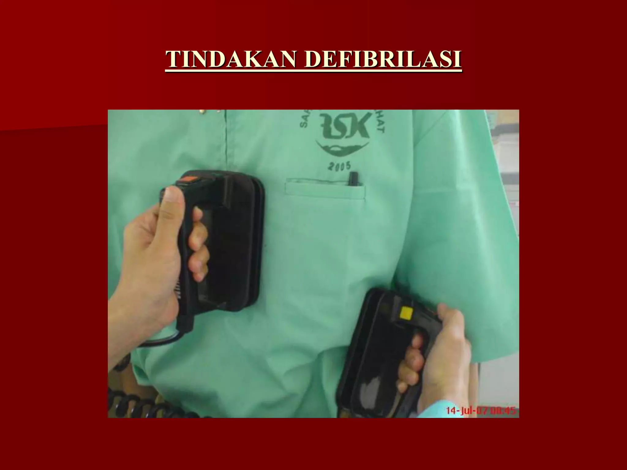 DC SYOCK N ARITMIA LETAL.ppt