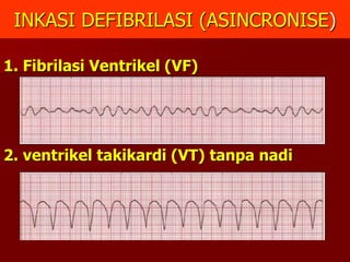 DC SYOCK N ARITMIA LETAL.ppt