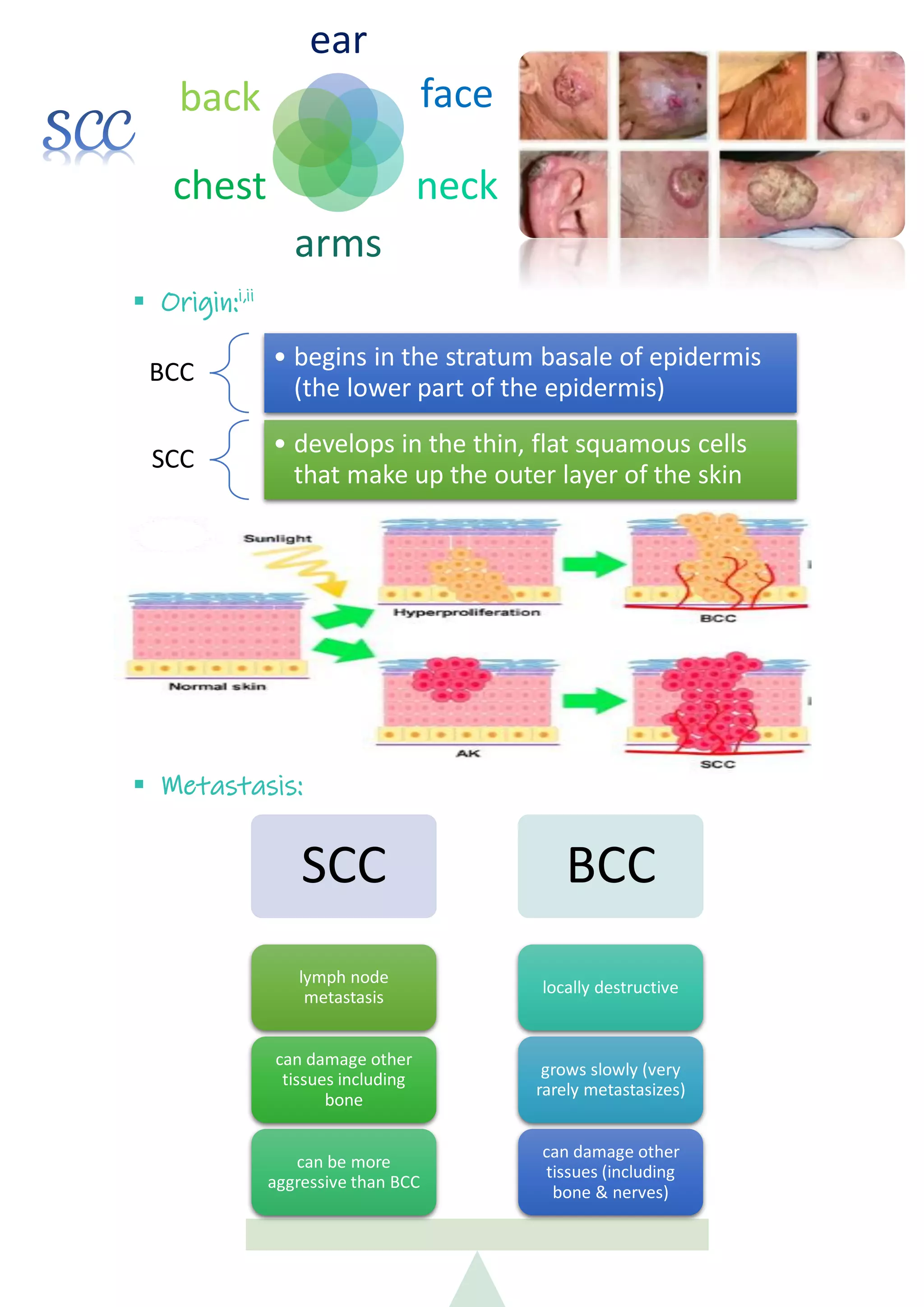 difference between BCC & SCC | PDF