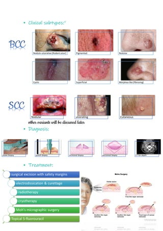 difference between BCC & SCC | PDF
