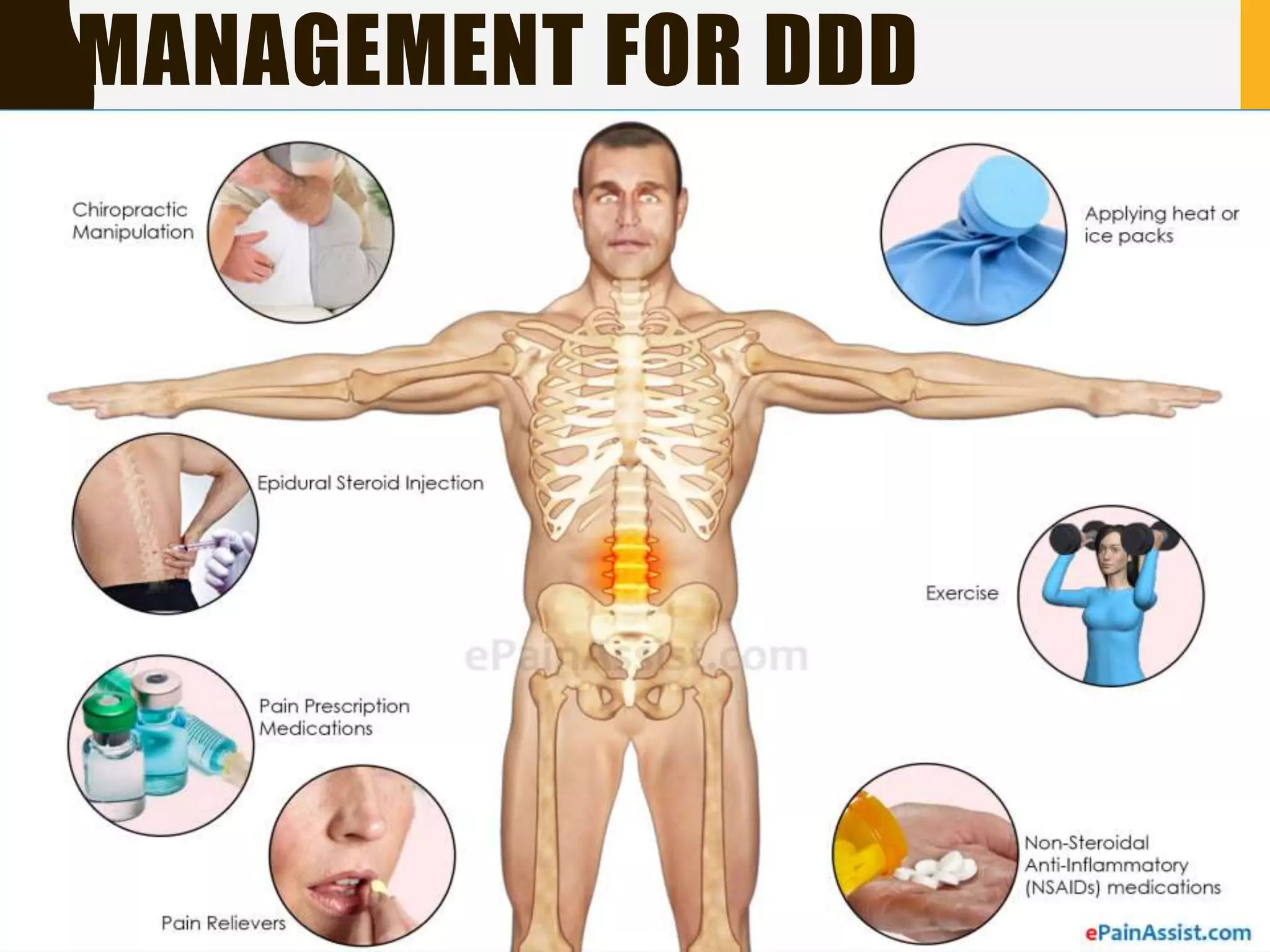 Degenerative disc disease (DDD) | PPTX