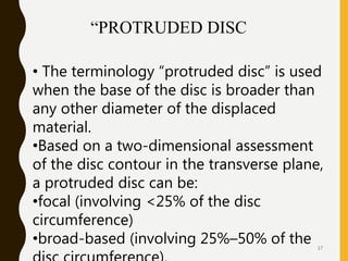 Degenerative disc disease (DDD) | PPTX