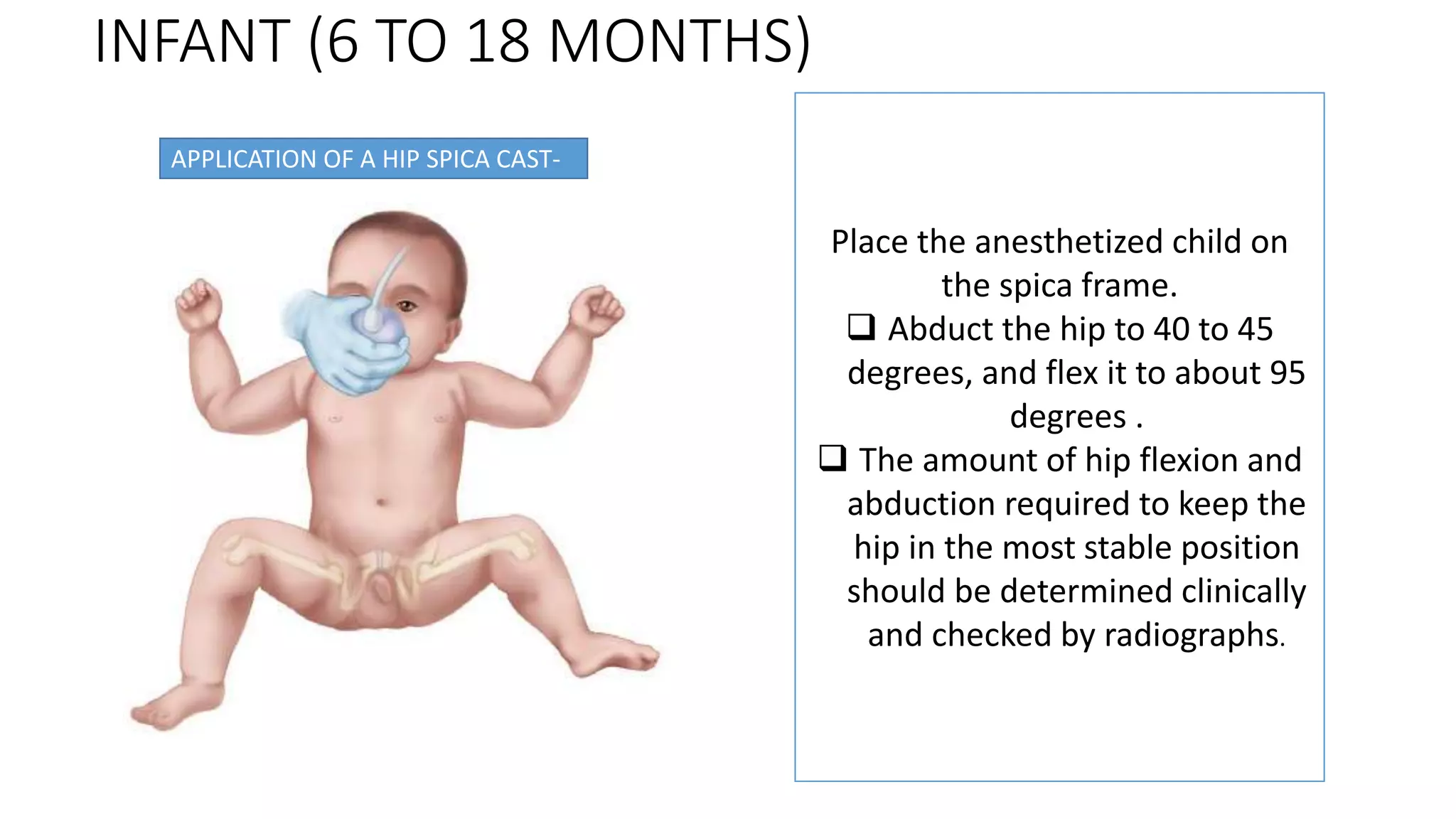 Developmental dysplasia of hip | PPTX