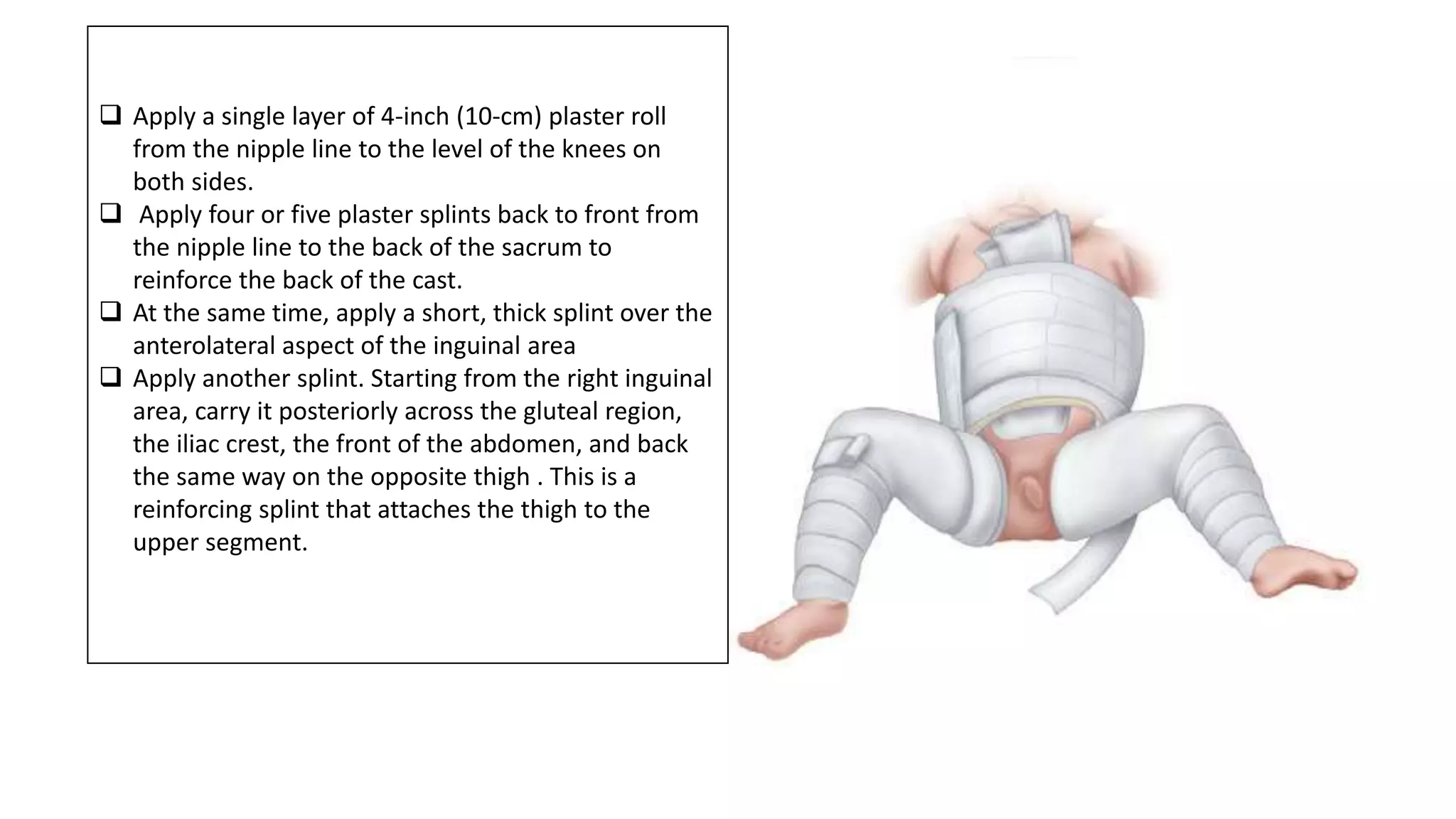 Developmental dysplasia of hip | PPTX