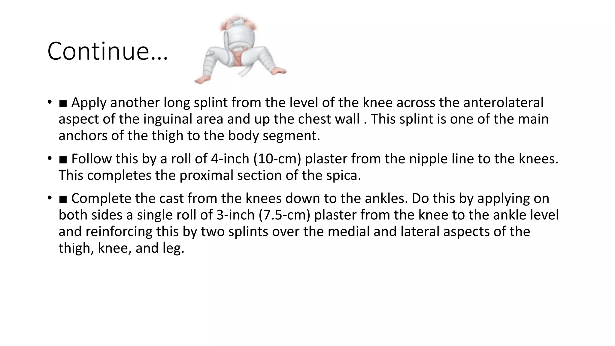 Developmental dysplasia of hip | PPTX