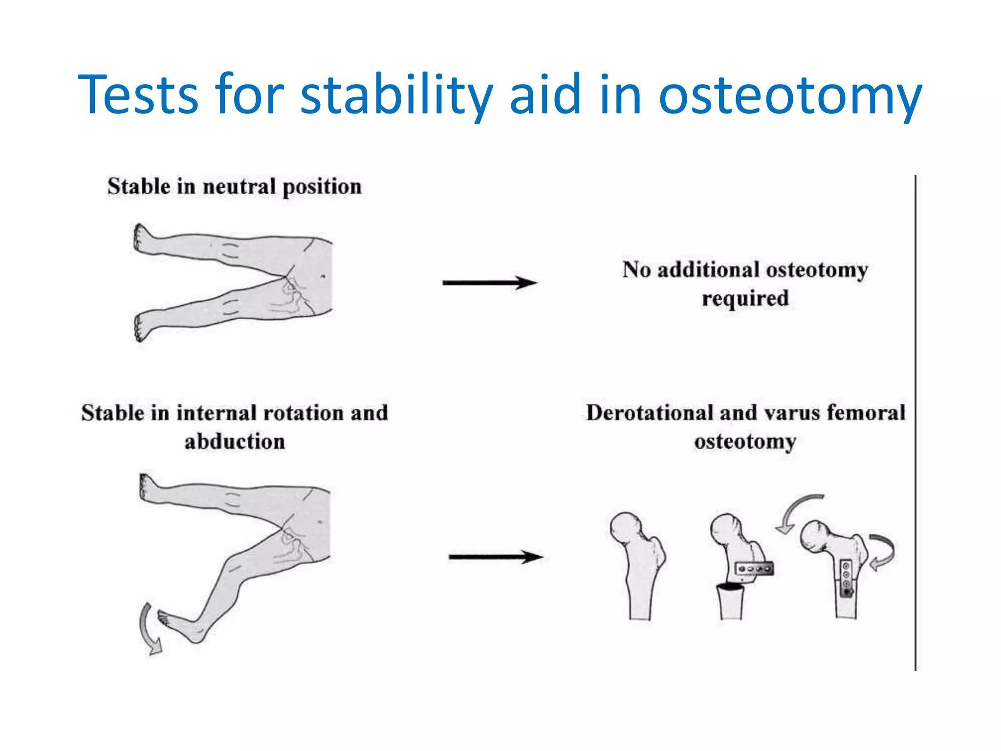 Developmental dysplasia of hip Ddh | PPTX