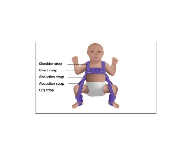Developmental dysplasia of hip Ddh | PPTX | Pregnancy | Reproductive Health