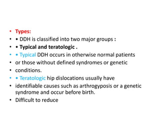 Developmental dysplasia of hip Ddh | PPTX