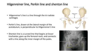 DDH BY DR AJAY SHAH | PPT