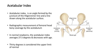 DDH BY DR AJAY SHAH | PPT