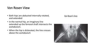 DDH BY DR AJAY SHAH | PPT