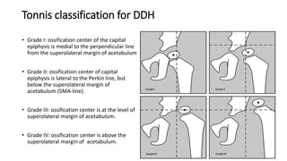 DDH BY DR AJAY SHAH | PPT