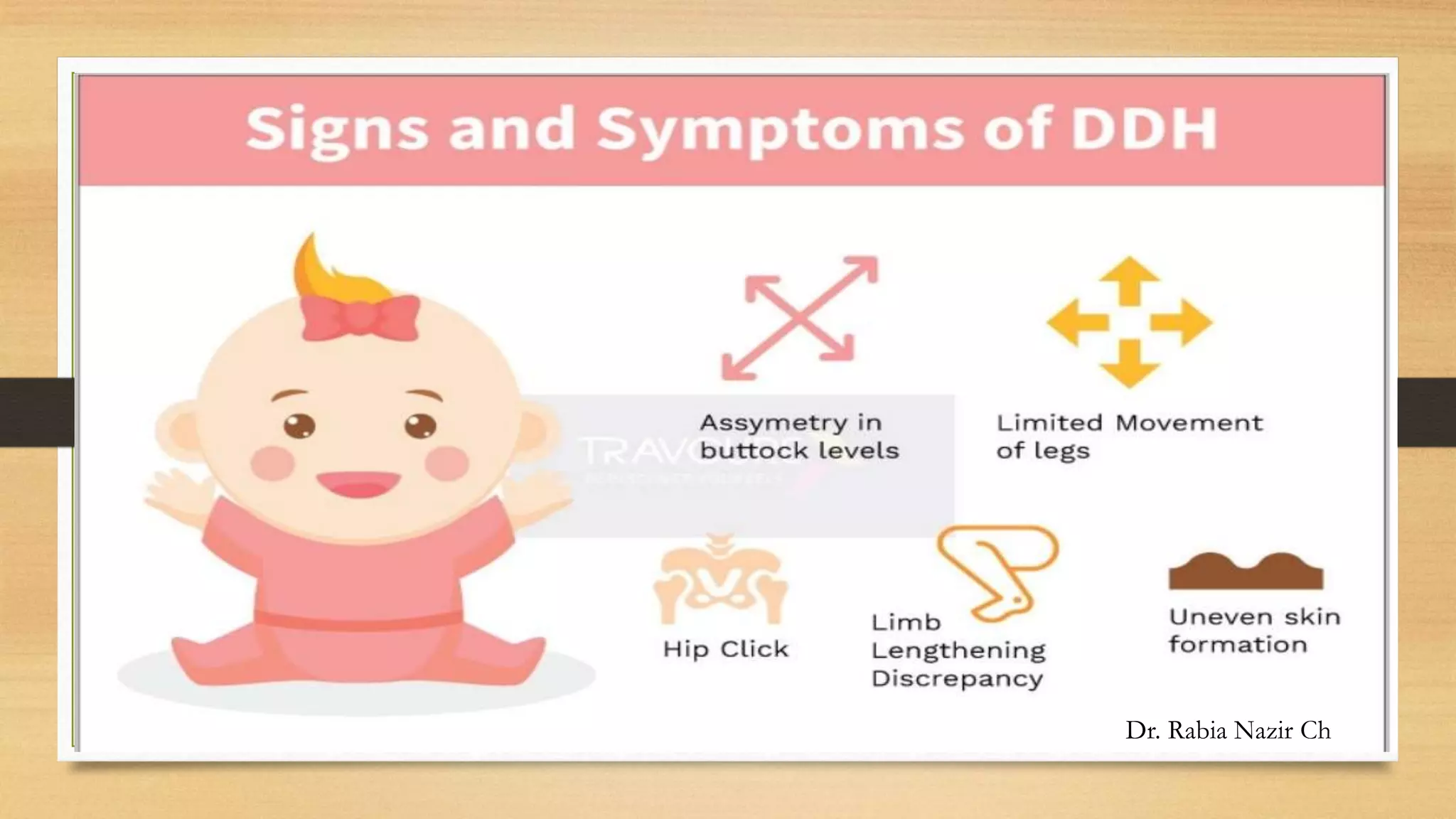 Developmental dysplasia of hip Radiology | PPTX