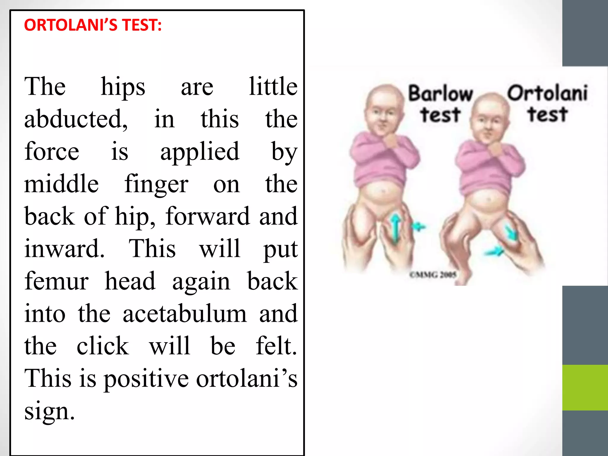 Developmental Dysplasia Of Hip Or Displacement Of Hip | PPTX