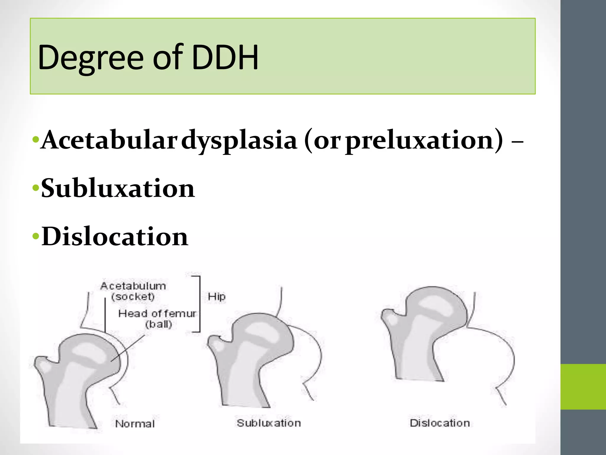 Developmental Dysplasia Of Hip Or Displacement Of Hip | PPTX