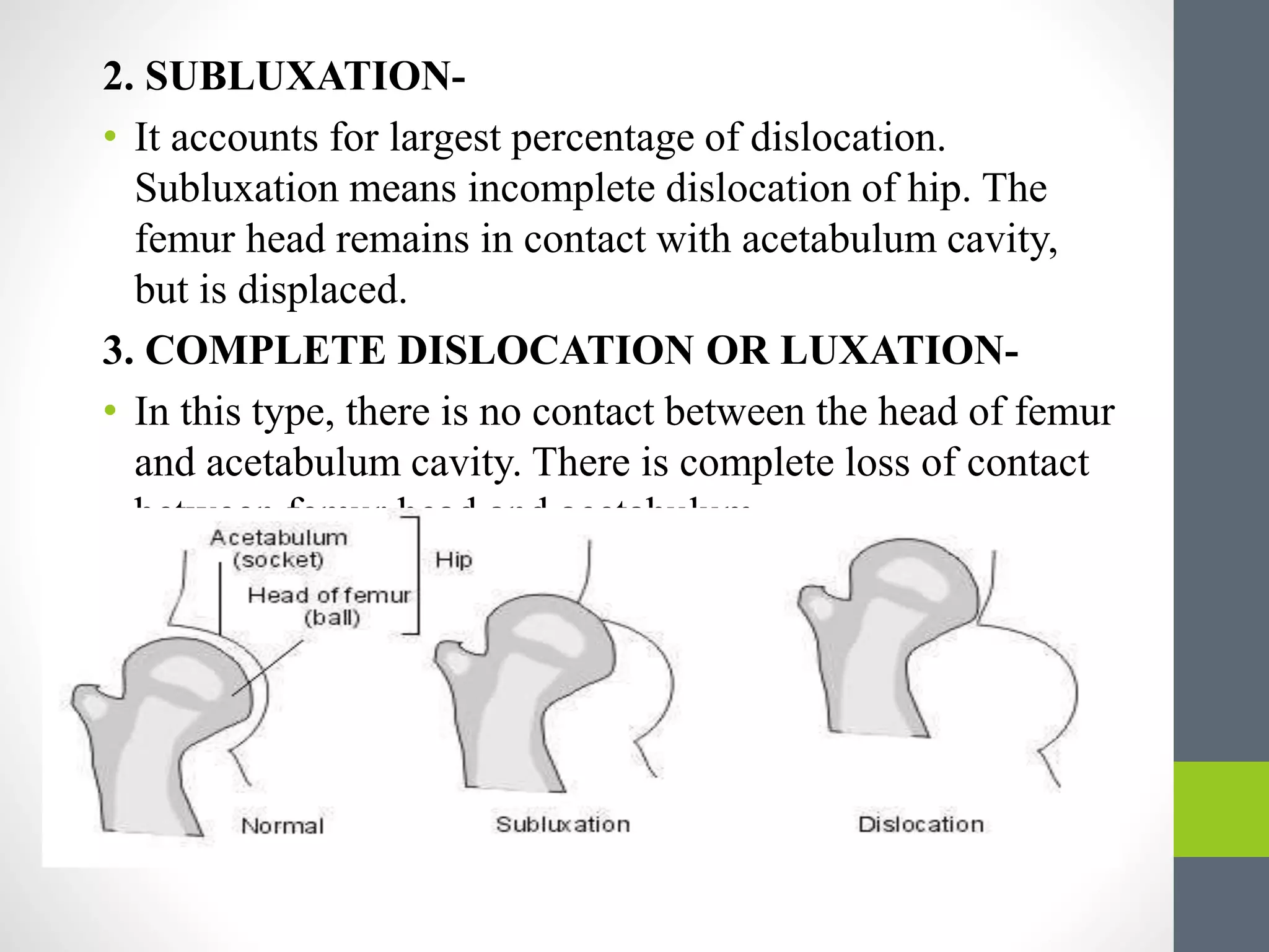 Developmental Dysplasia Of Hip Or Displacement Of Hip | PPTX