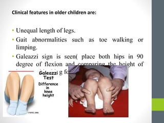 Developmental Dysplasia Of Hip Or Displacement Of Hip | PPT