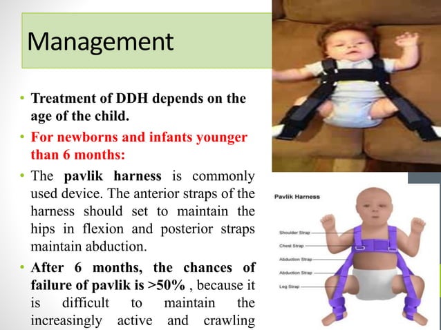 Developmental Dysplasia Of Hip Or Displacement Of Hip | PPT