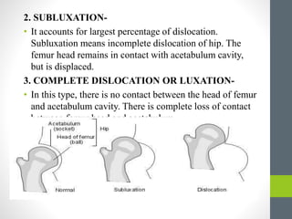 Developmental Dysplasia Of Hip Or Displacement Of Hip | PPT