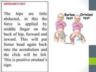 Developmental Dysplasia Of Hip Or Displacement Of Hip | PPT