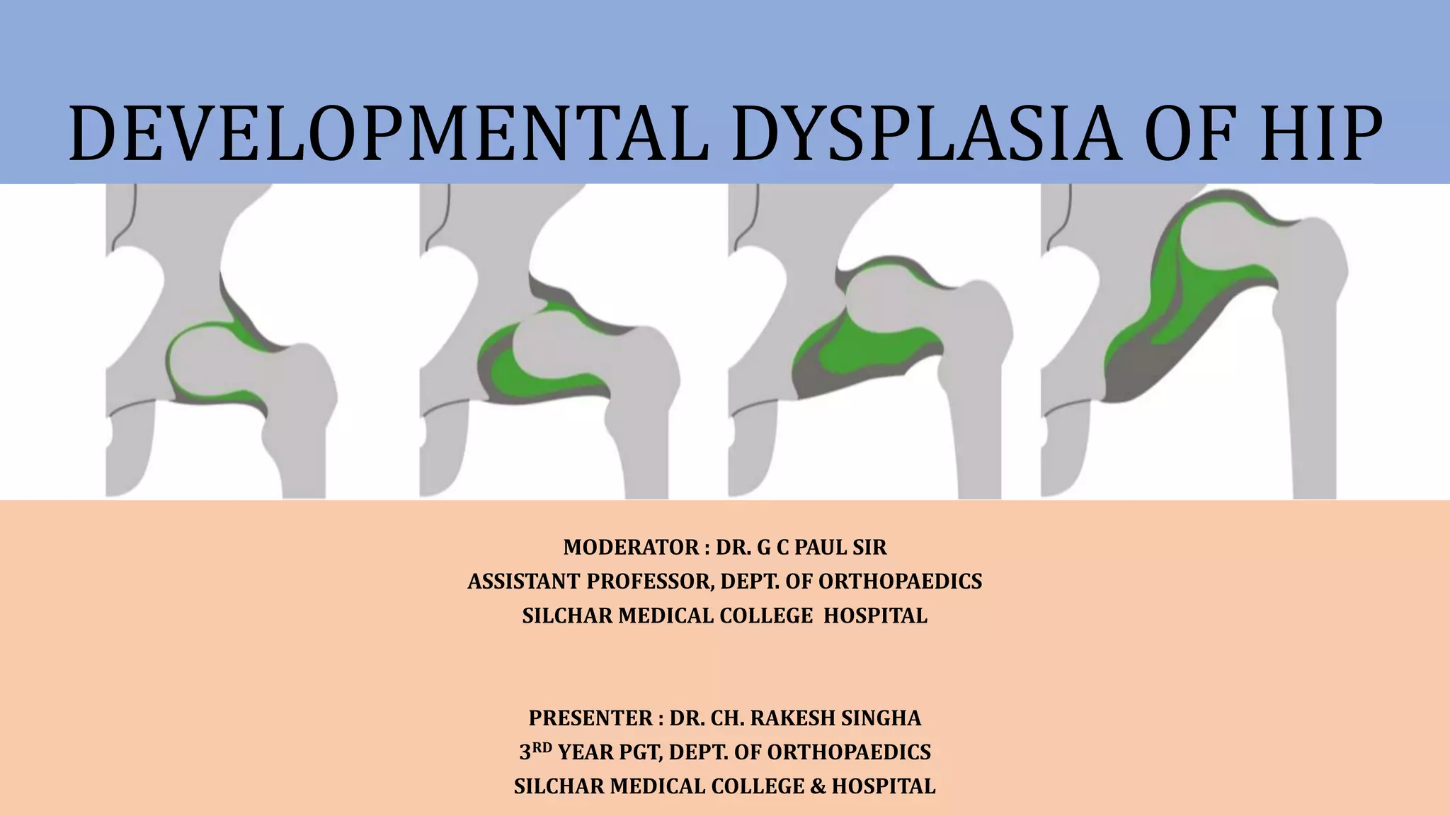 DDH (Developmental Dysplasia of Hip).pptx