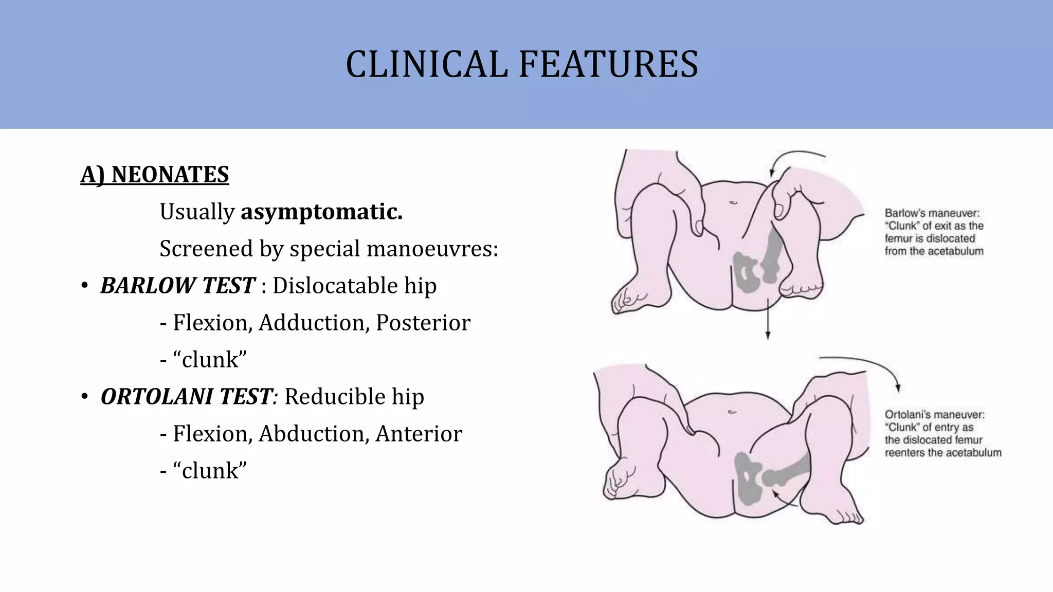 DDH (Developmental Dysplasia of Hip).pptx
