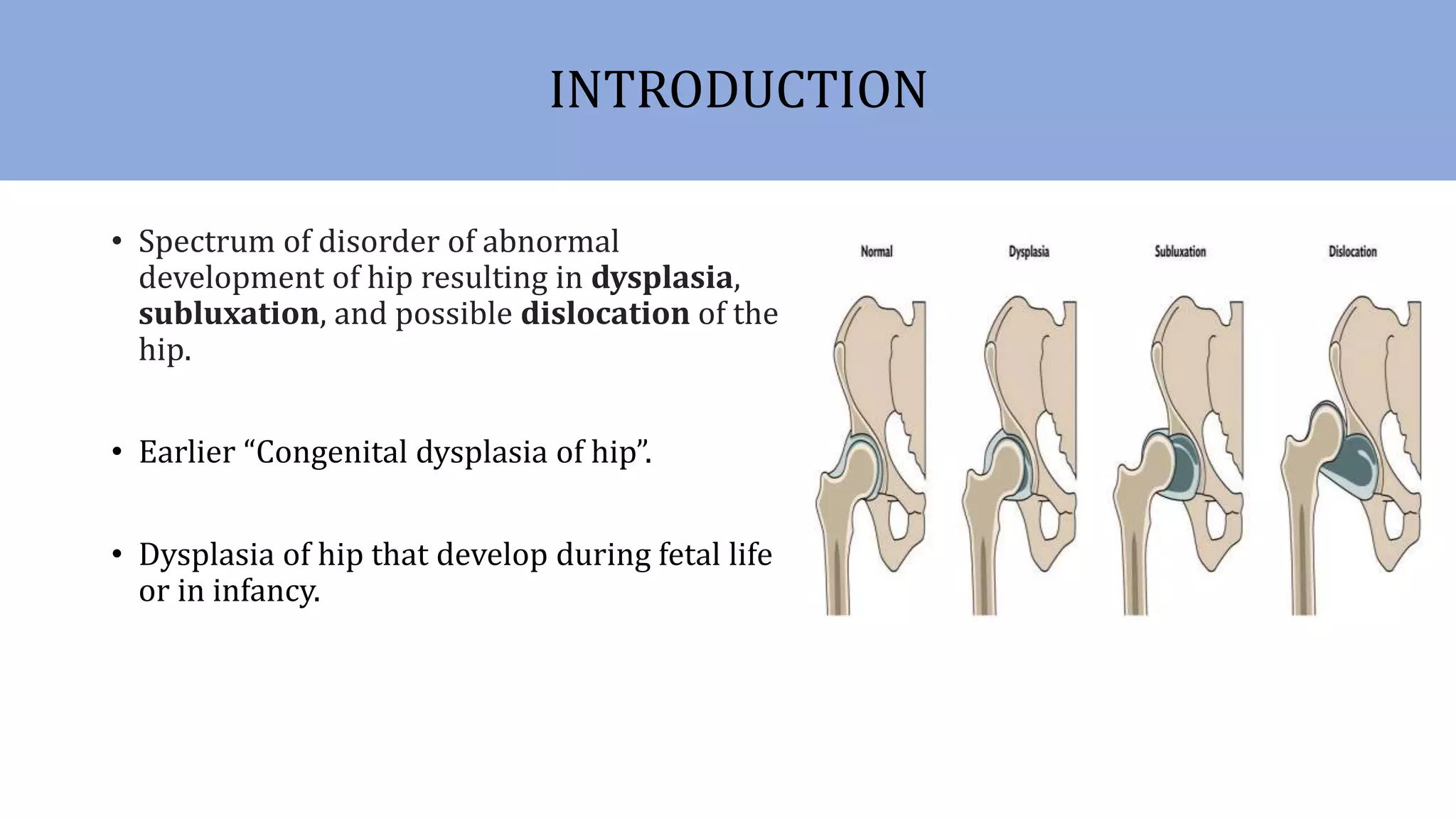 DDH (Developmental Dysplasia of Hip).pptx