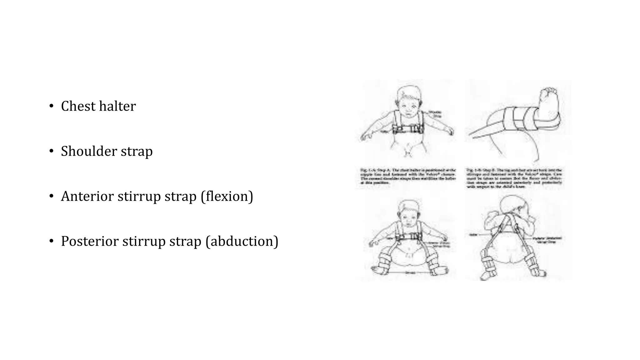 DDH (Developmental Dysplasia of Hip).pptx