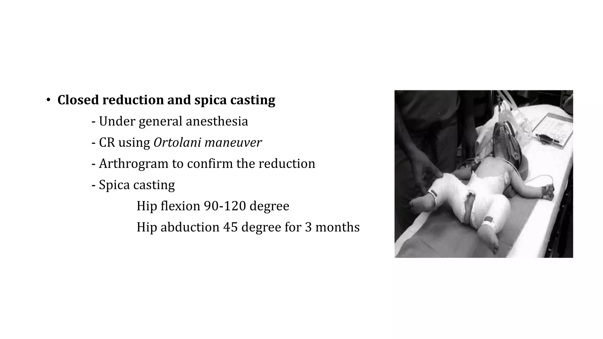 DDH (Developmental Dysplasia of Hip).pptx