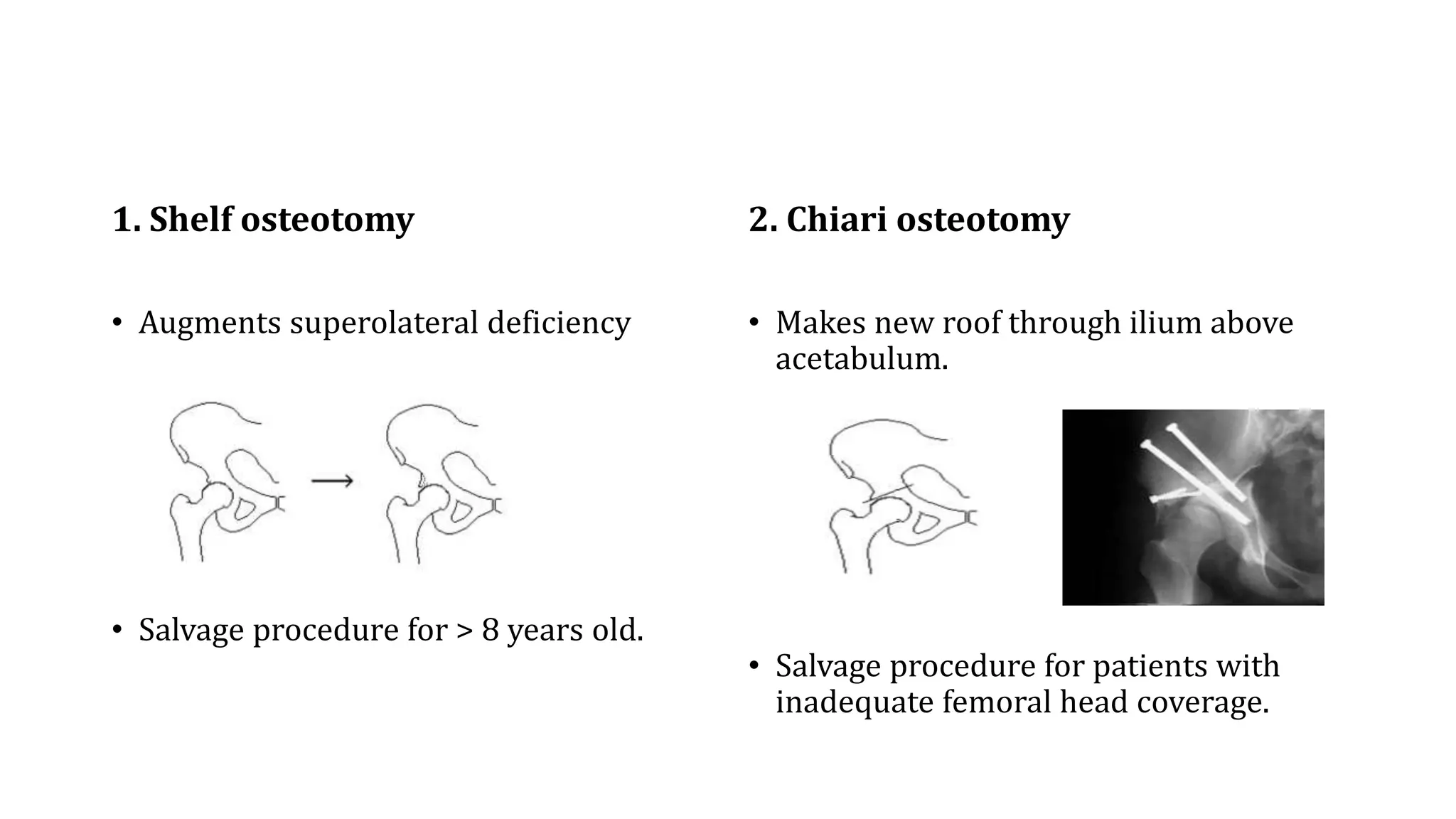 DDH (Developmental Dysplasia of Hip).pptx