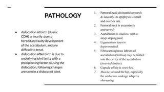 Developmental Dysplasia of Hip | PPT