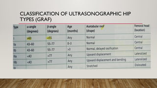 Clinical accessment of developmental dysplasia of hip | PPTX