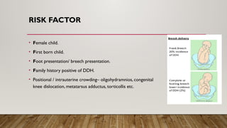 Clinical accessment of developmental dysplasia of hip | PPTX