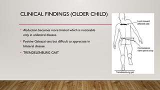Clinical accessment of developmental dysplasia of hip | PPTX