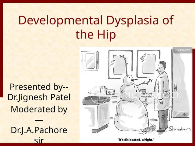 DDH.pptx Developmental dysplasia of hips | PPTX