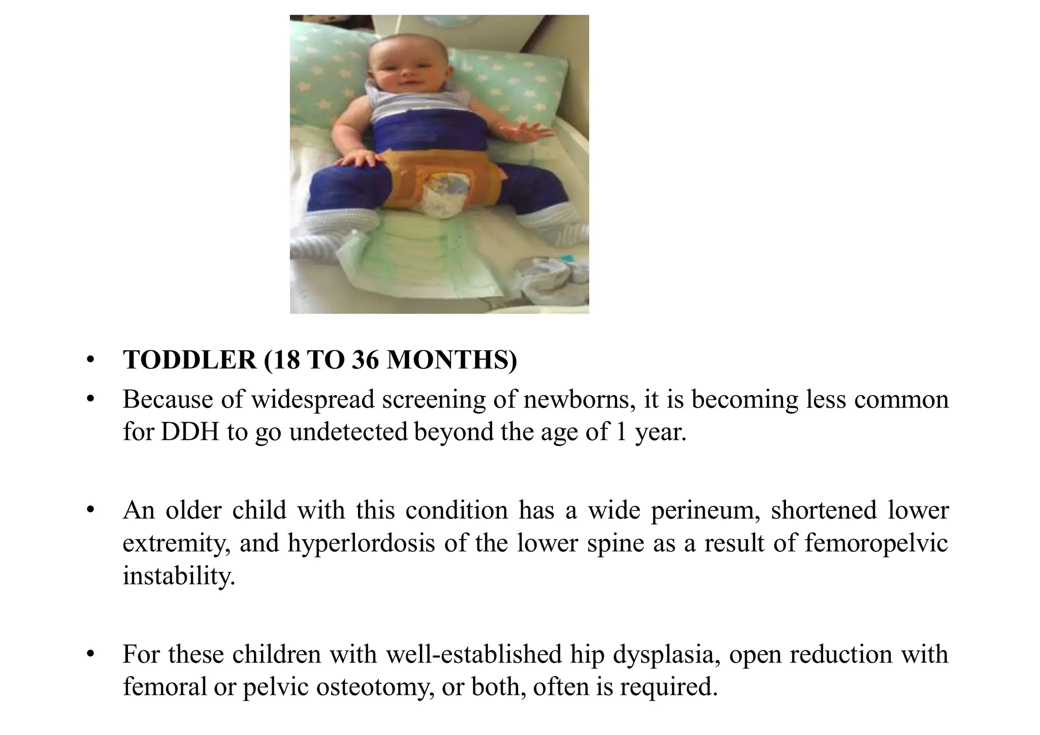 DEVELOPMENTAL DYSPLASIA OF HIP PHYSIOTHERAPY NOTES.pdf