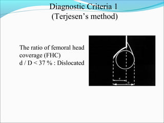 DEVELOPMENTAL DYSPLASIA of THE NEONATAL HIP JOINT, Dr TRẦN NGÂN CHÂU | PPT