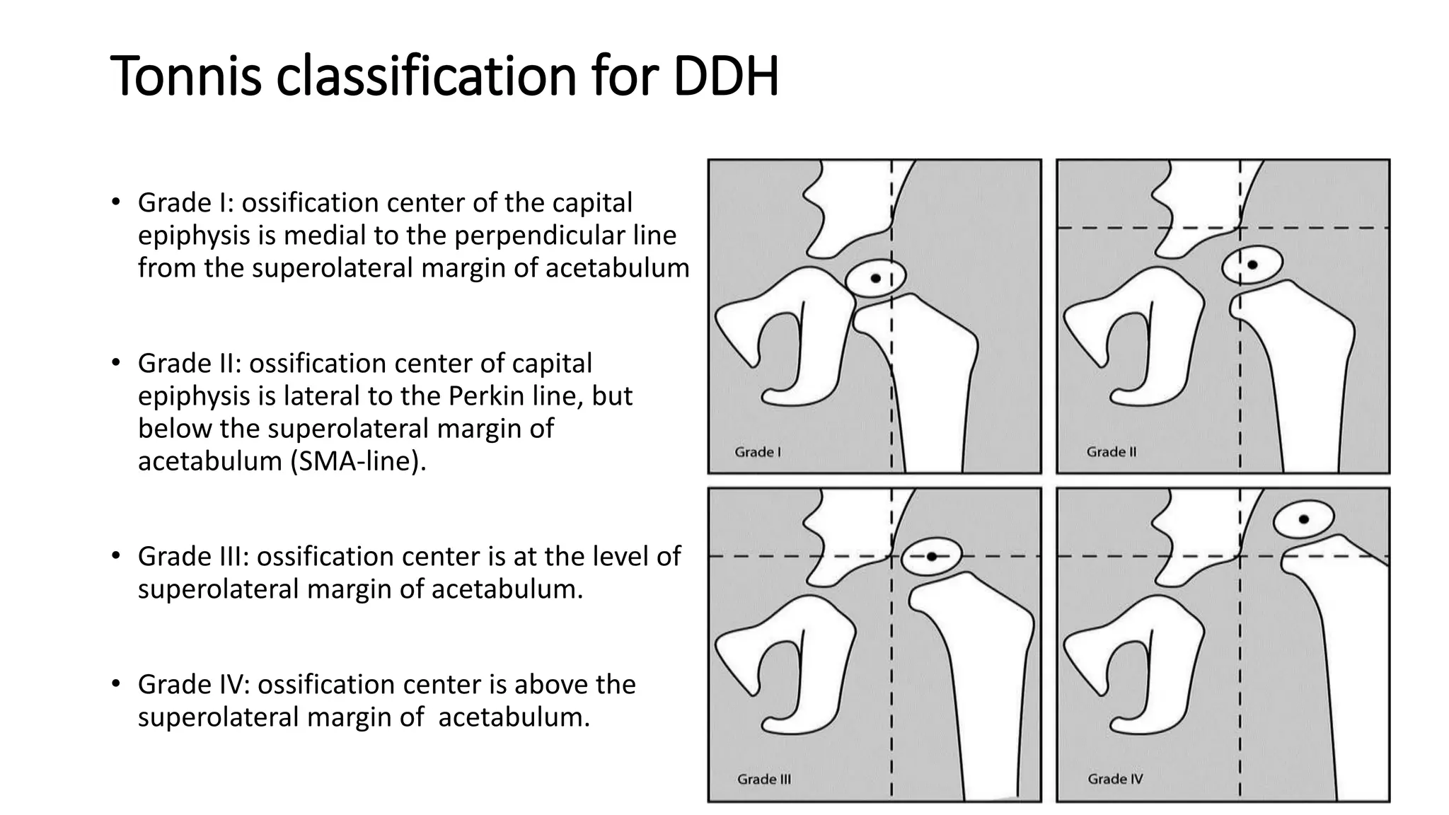 ddh-PRESENTATION in orthopaedics and anatomy.pptx