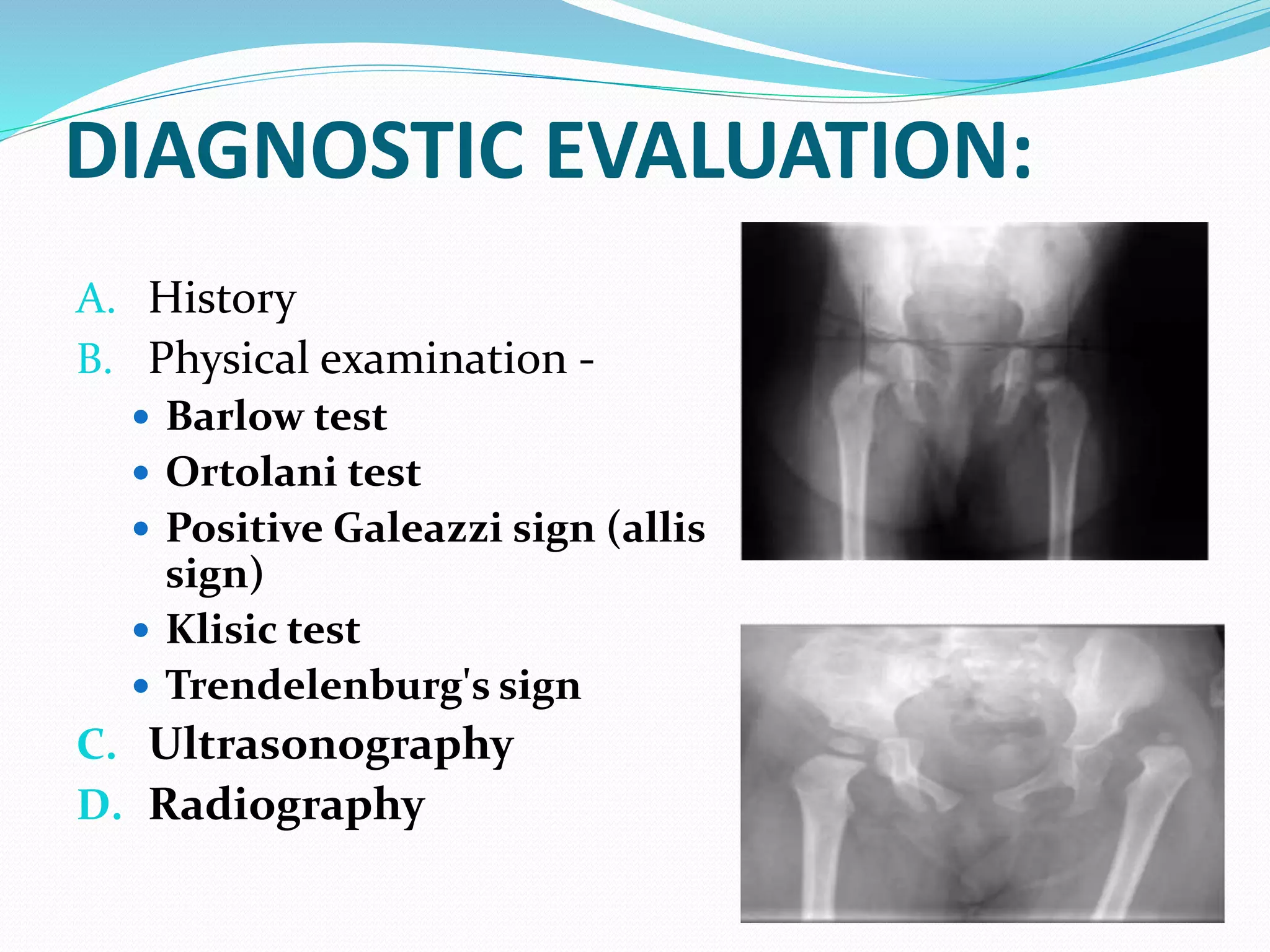 Hip dislocation | PPSX