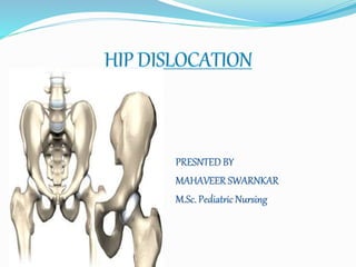 Hip dislocation | PPSX
