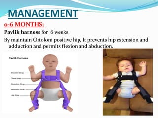 Hip dislocation | PPSX