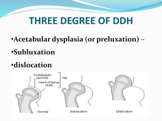 Hip dislocation | PPT