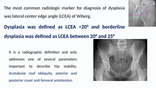 DDH in ADOLESCENTS overview of diagnosis and treatment.pptx