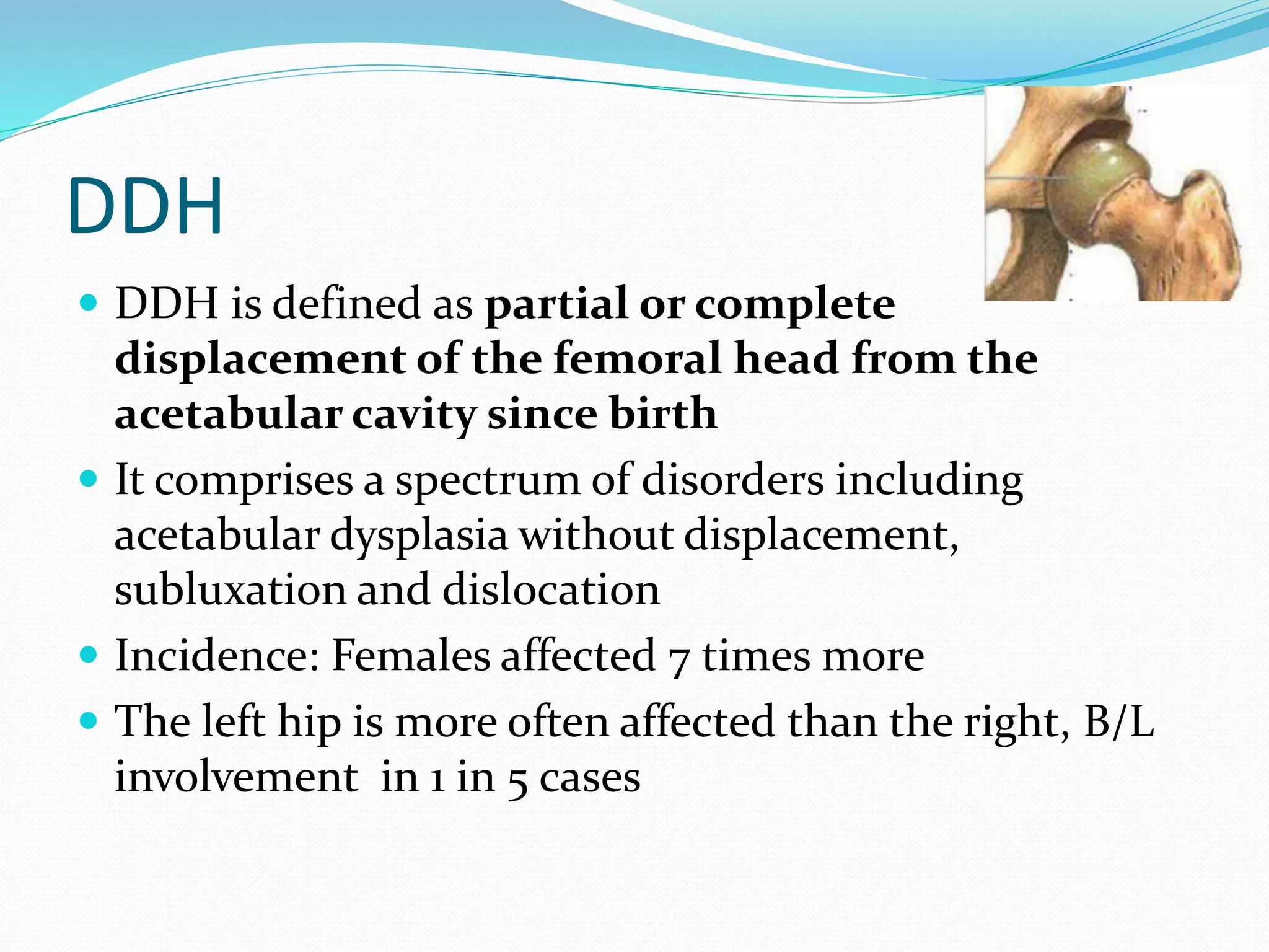 Developmental Dysplasia of Hip | PPTX