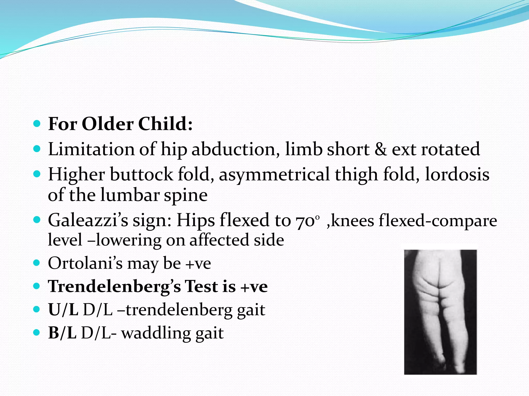 Developmental Dysplasia of Hip | PPTX