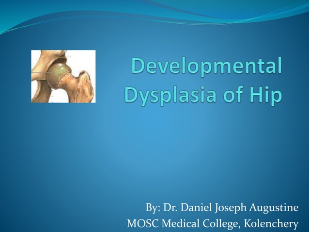 Developmental Dysplasia of Hip | PPTX
