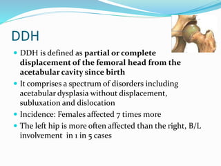 Developmental Dysplasia of Hip | PPTX