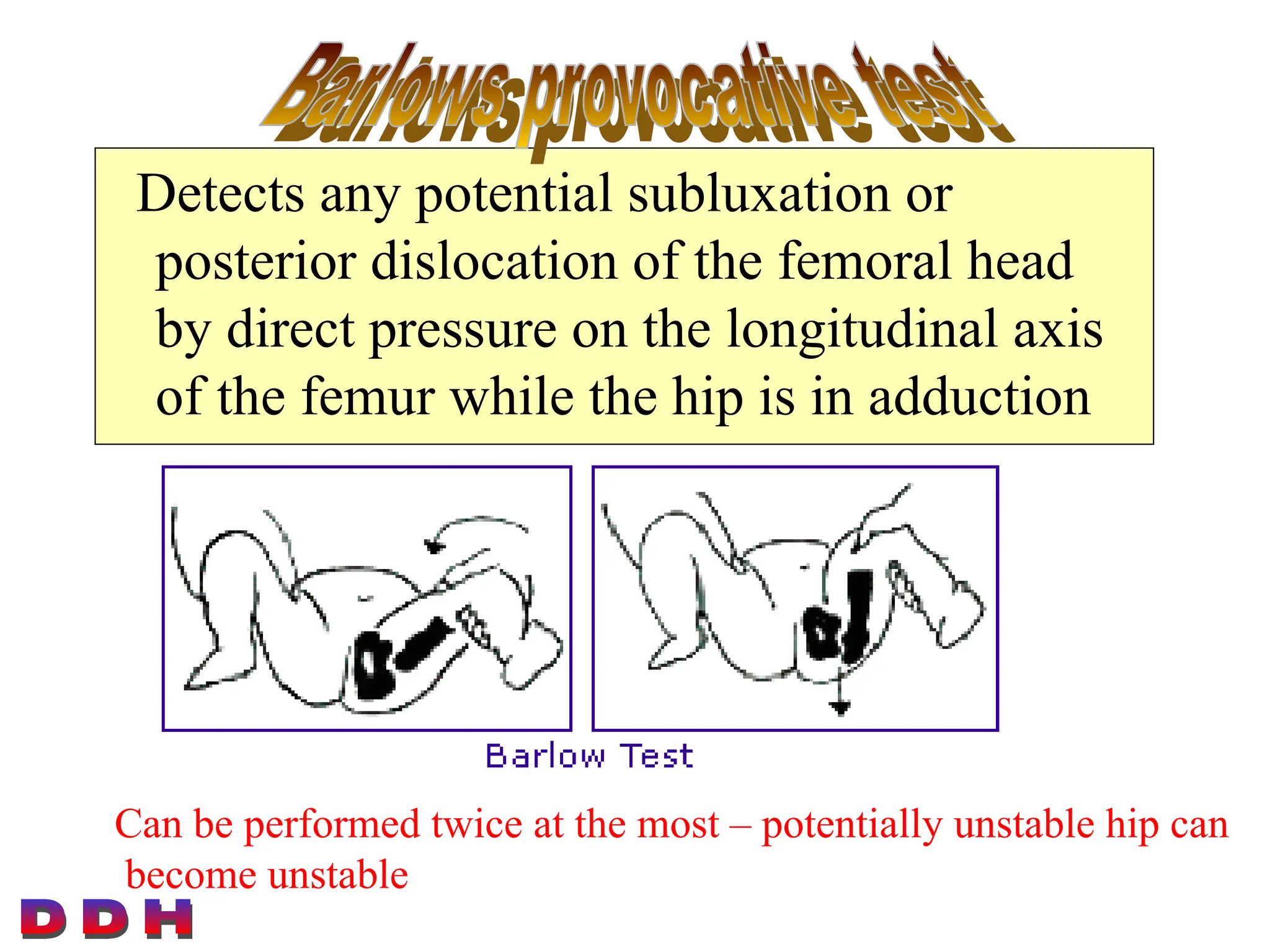 DDH Developmental Dysplasia of the Hip.ppt